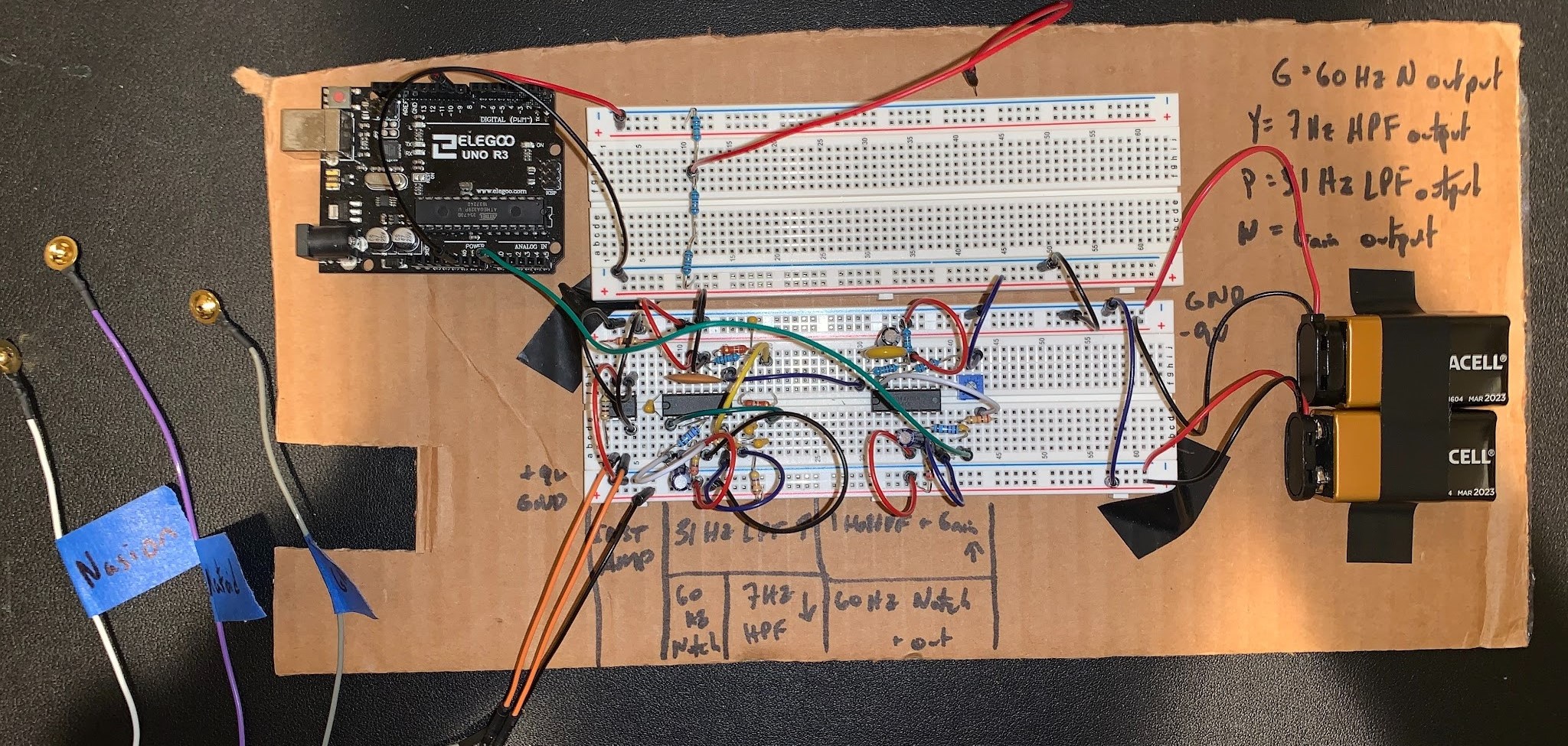 Alex Hadidi - Mini ECG