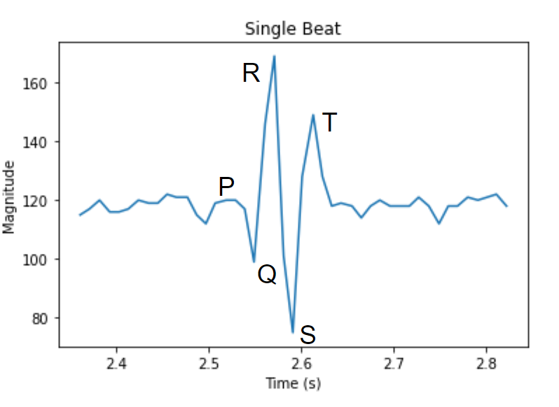 Alex Hadidi - Mini ECG